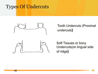 Surveyor and technique of Surveying in Removable partial denture | PPTX