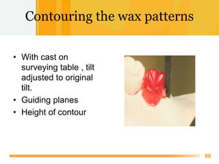 Surveyor and technique of Surveying in Removable partial denture | PPTX