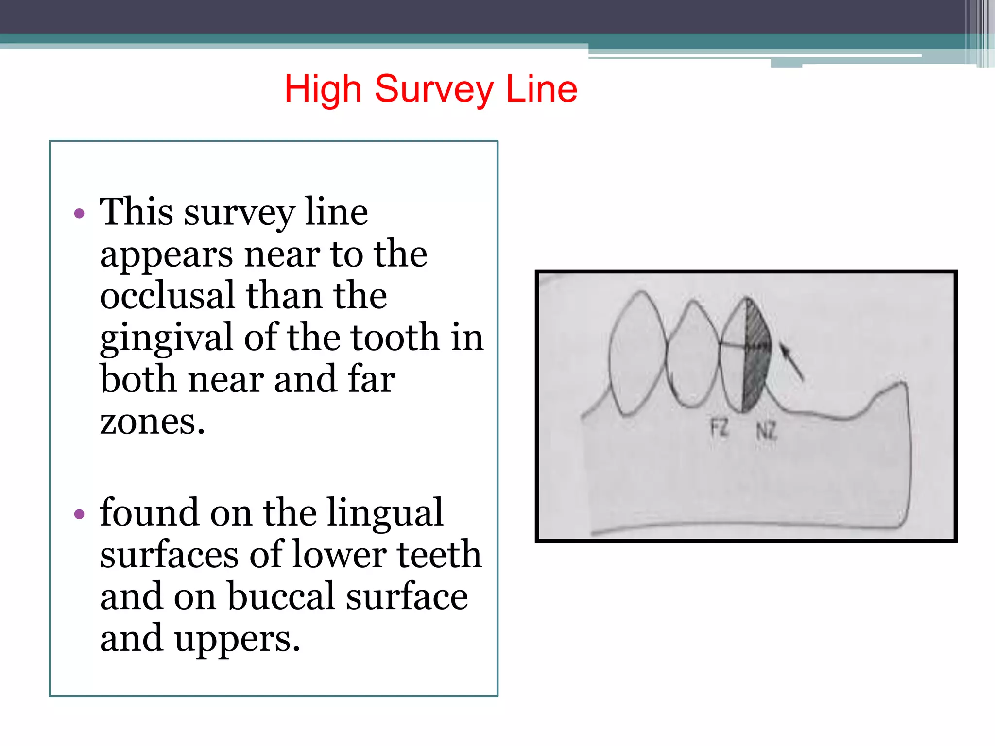 Dental Surveyor | PPTX