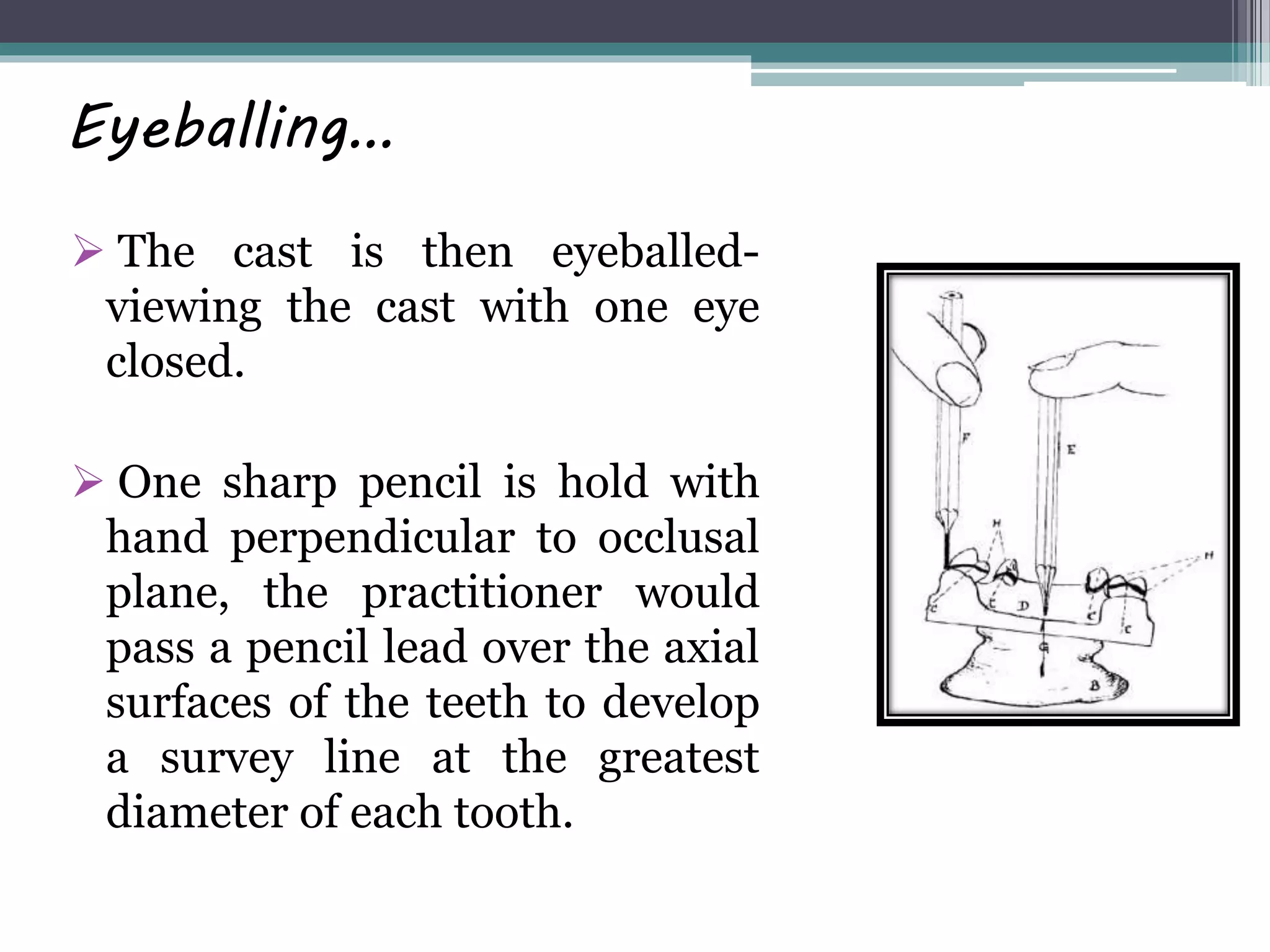 Dental Surveyor | PPTX