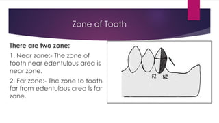 Dental Surveying | PDF | Dental Health | Diseases and Conditions