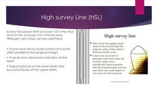 Dental Surveying | PDF | Dental Health | Diseases and Conditions