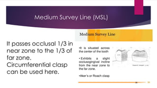Dental Surveying | PDF | Dental Health | Diseases and Conditions
