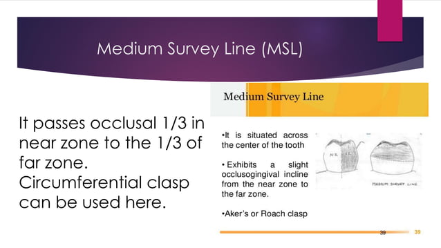 Dental Surveying | PDF | Dental Health | Diseases and Conditions