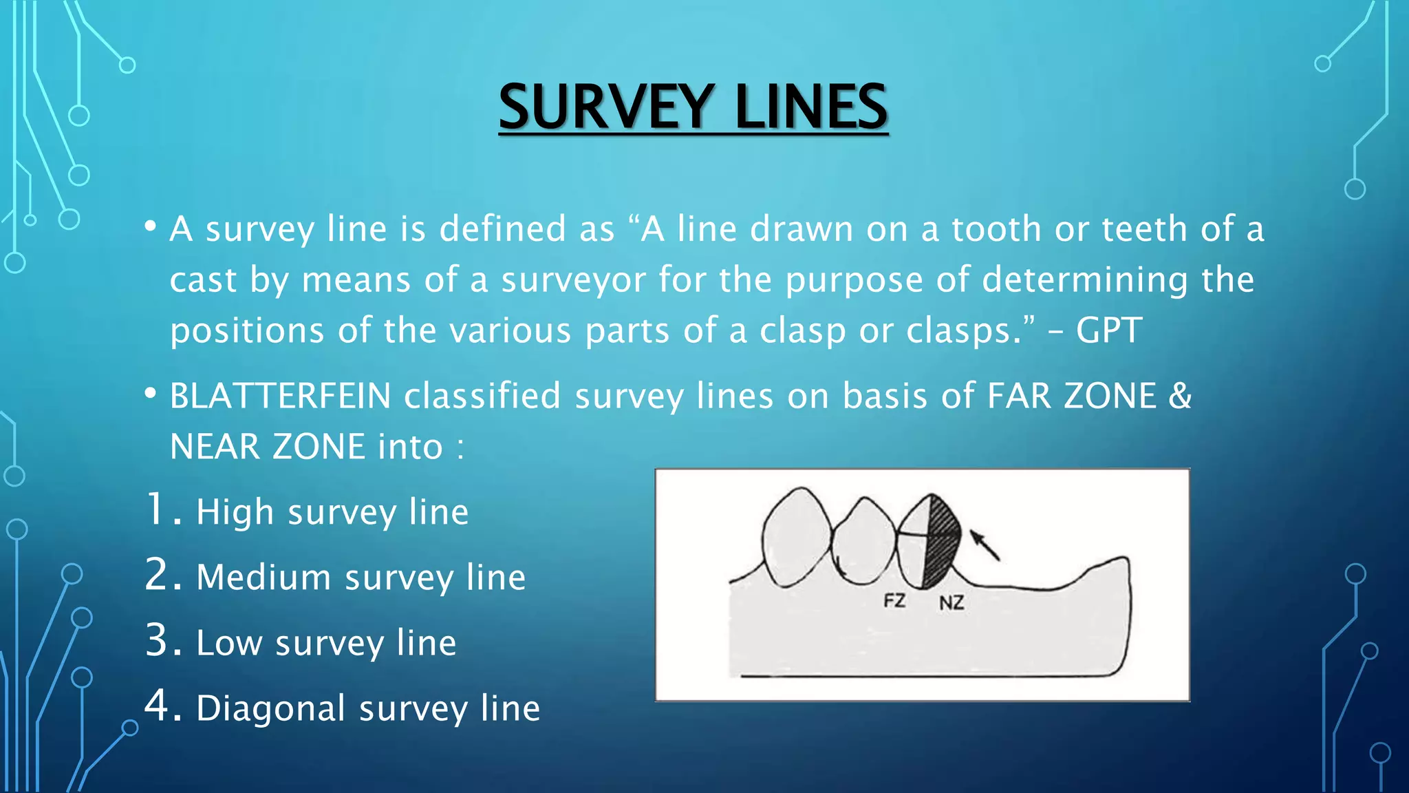 Surveying in Removable Prosthodontics | PPTX