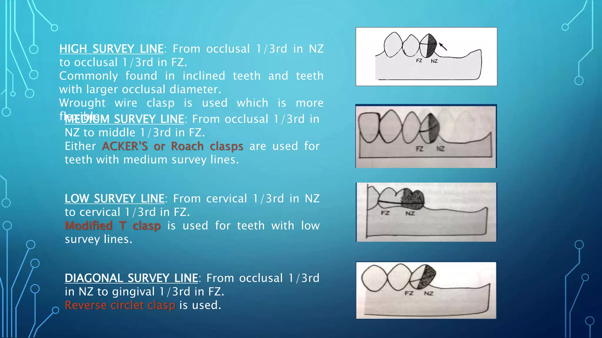Surveying in Removable Prosthodontics | PPTX