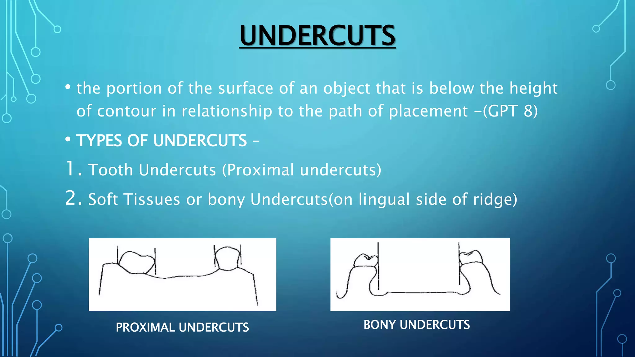 Surveying in Removable Prosthodontics | PPTX