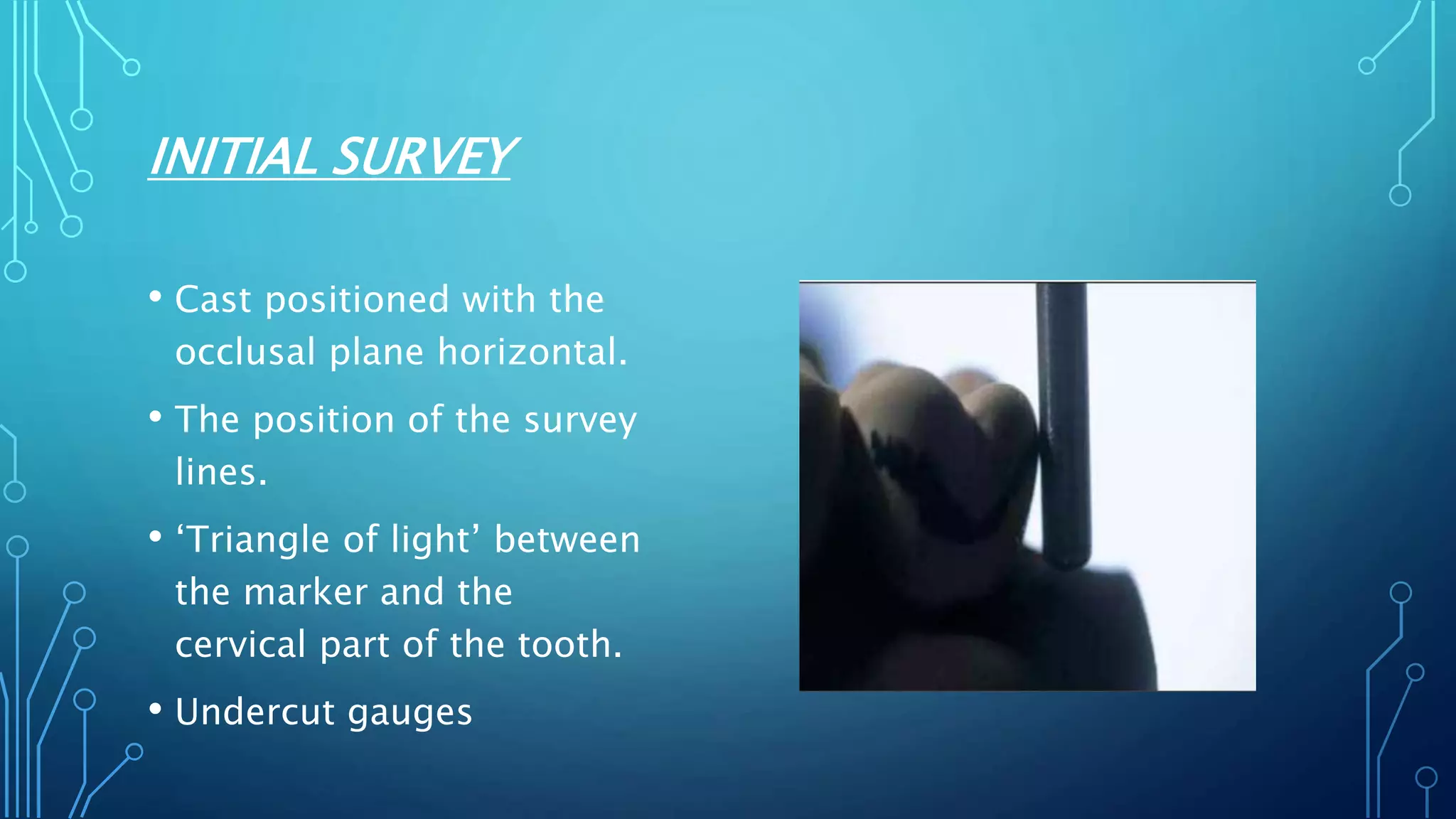 Surveying in Removable Prosthodontics | PPTX