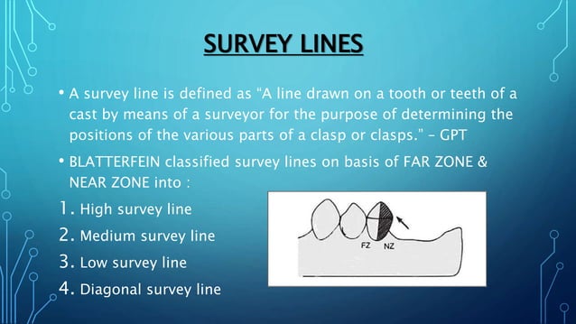 Surveying in Removable Prosthodontics | PPTX | Dental Health | Diseases ...