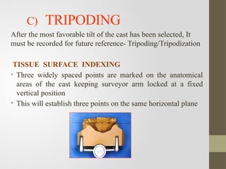 Comprehensive Guide to Surveying in Removable Partial Denture Design | PPTX