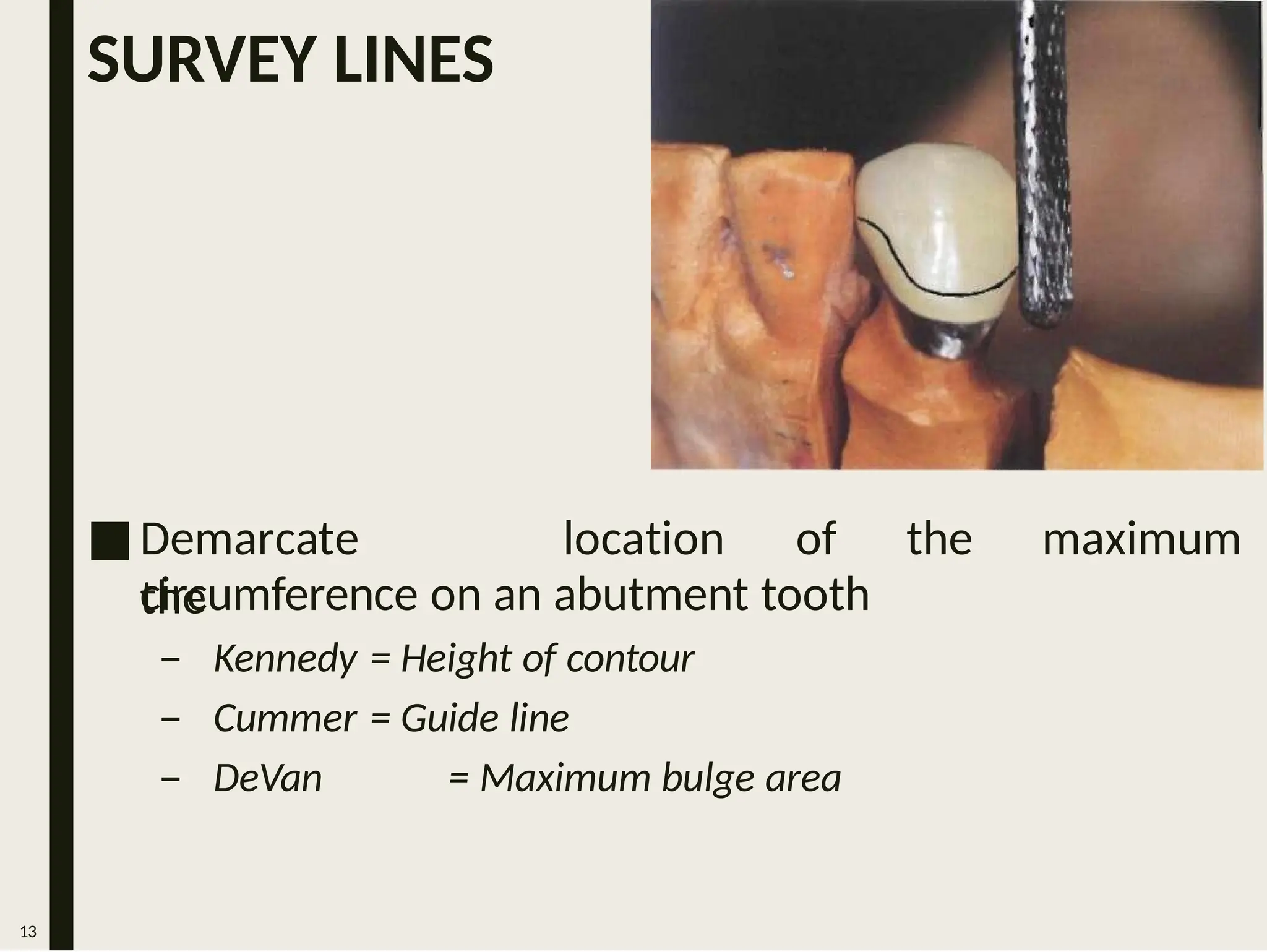 Surveying-Full procedure and surveyors.pptx