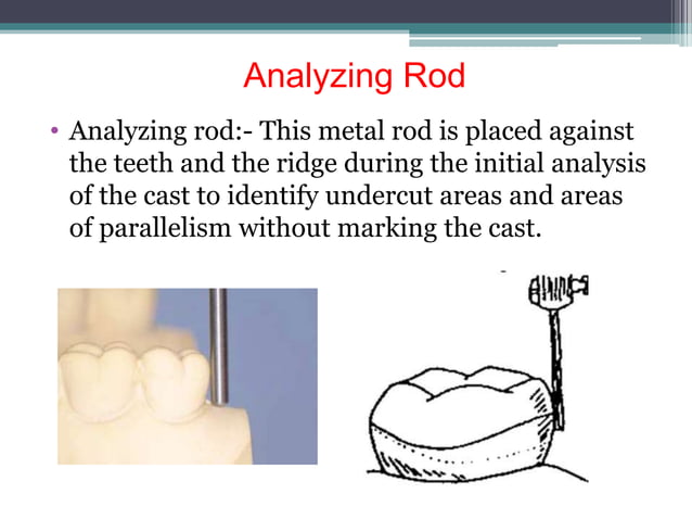 surveying-of diganostic cast and master cast.pptx | Oral care ...