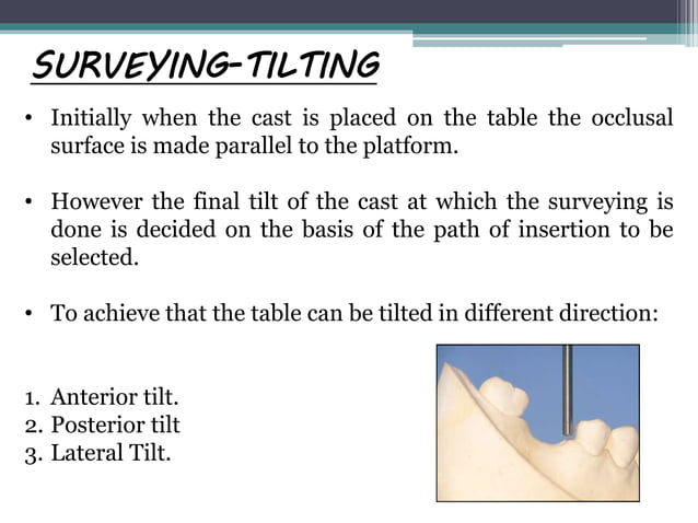 surveying-of diganostic cast and master cast.pptx | Oral care ...