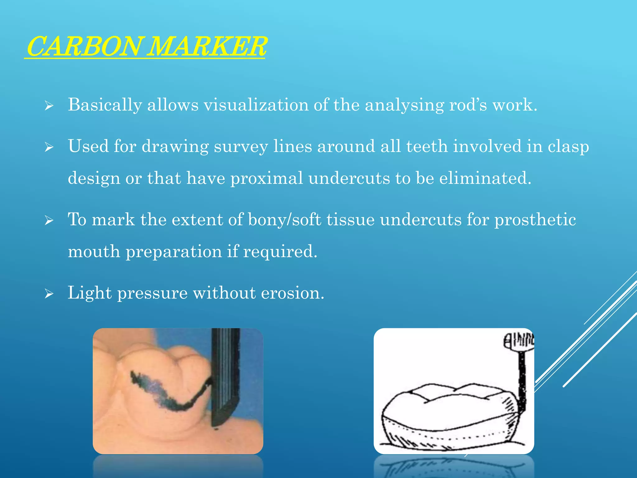 Surveyors and surveying in RPD | PPTX