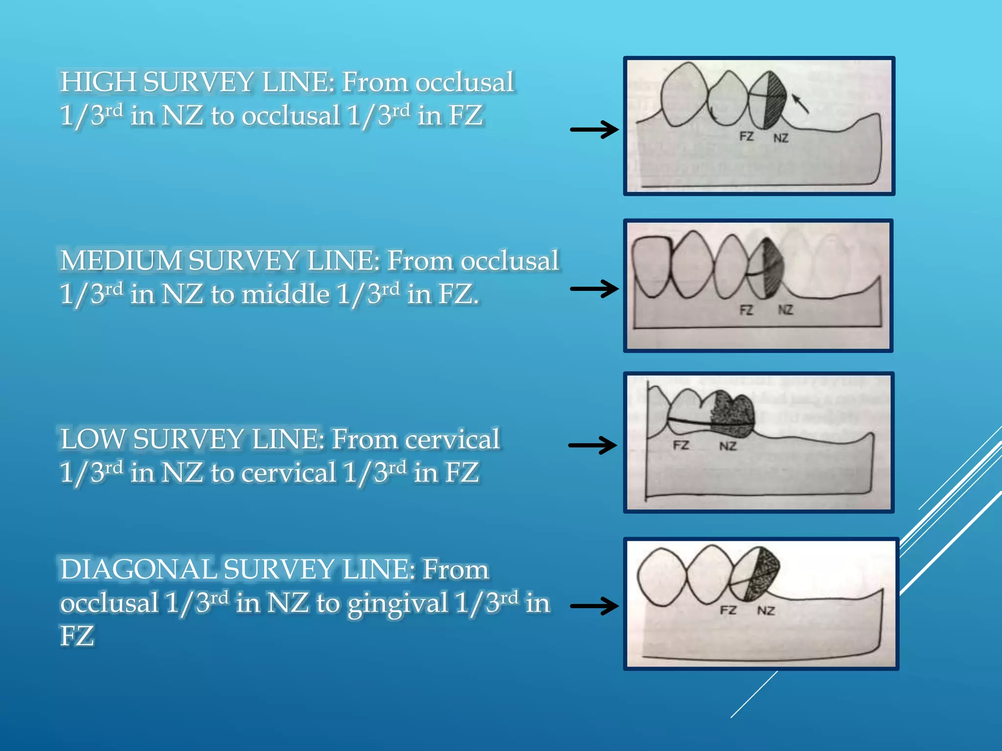 Surveyors and surveying in RPD | PPTX