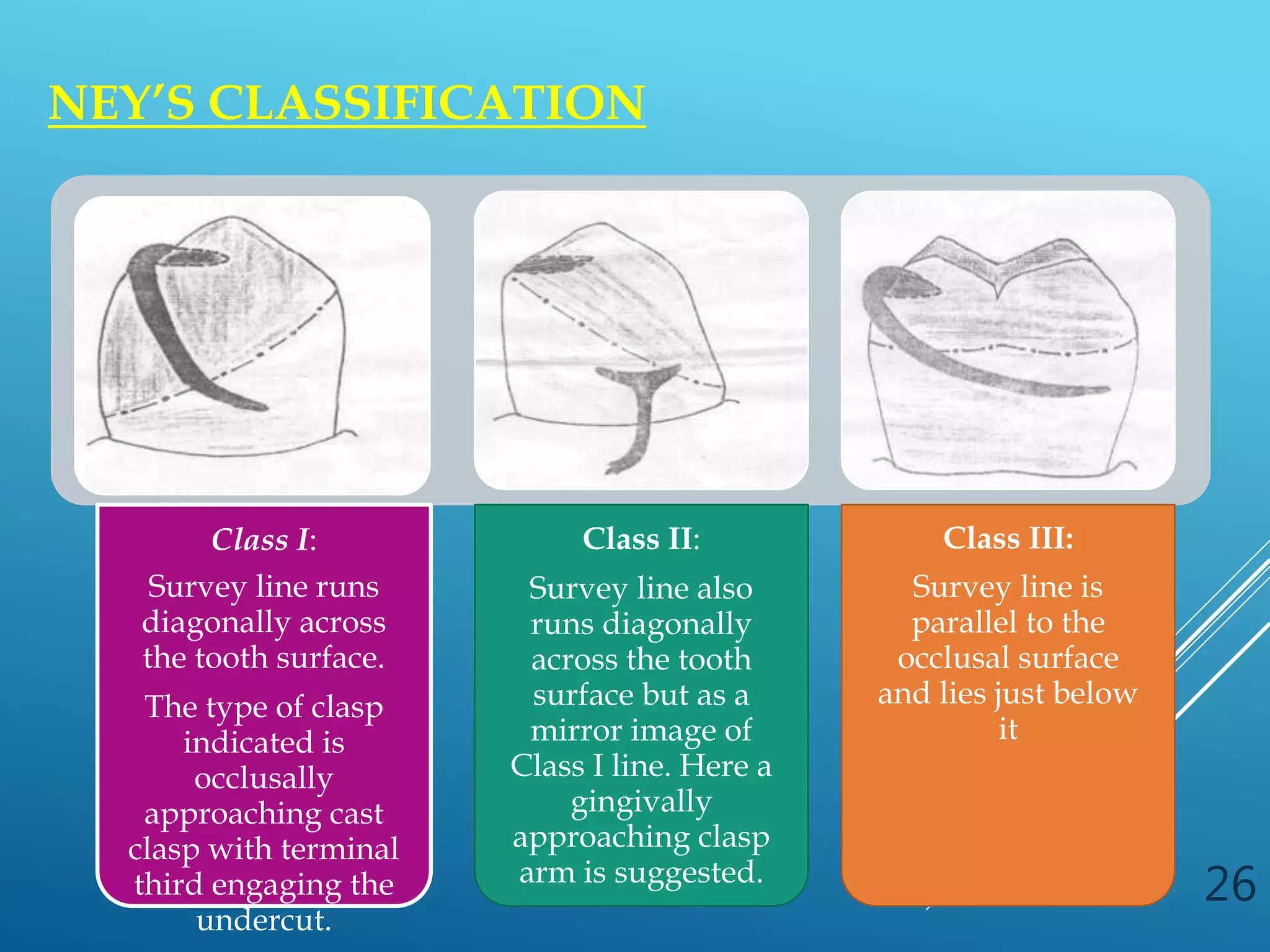 Surveyors and surveying in RPD | PPTX