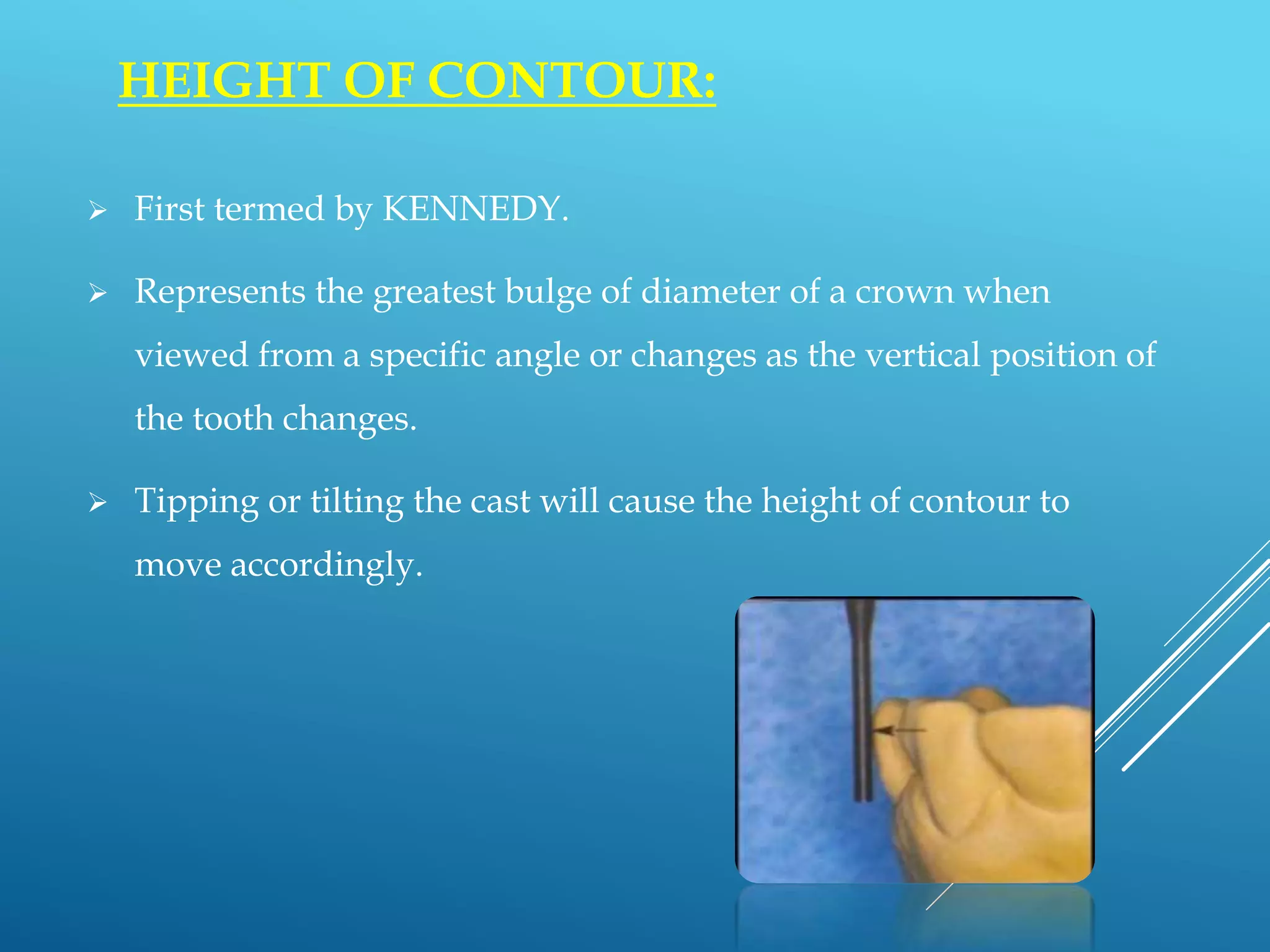 Surveyors and surveying in RPD | PPTX