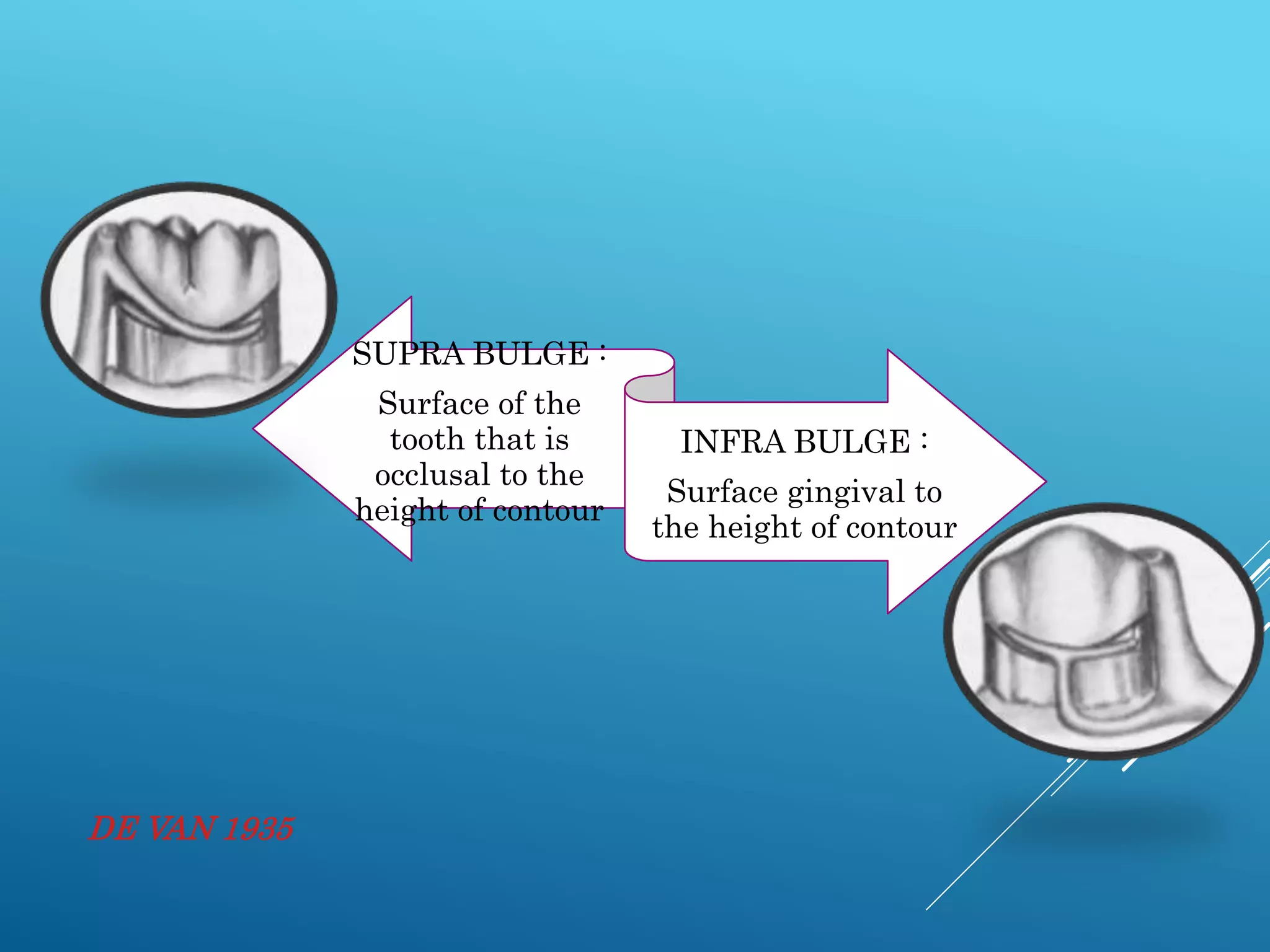 Surveyors and surveying in RPD | PPTX