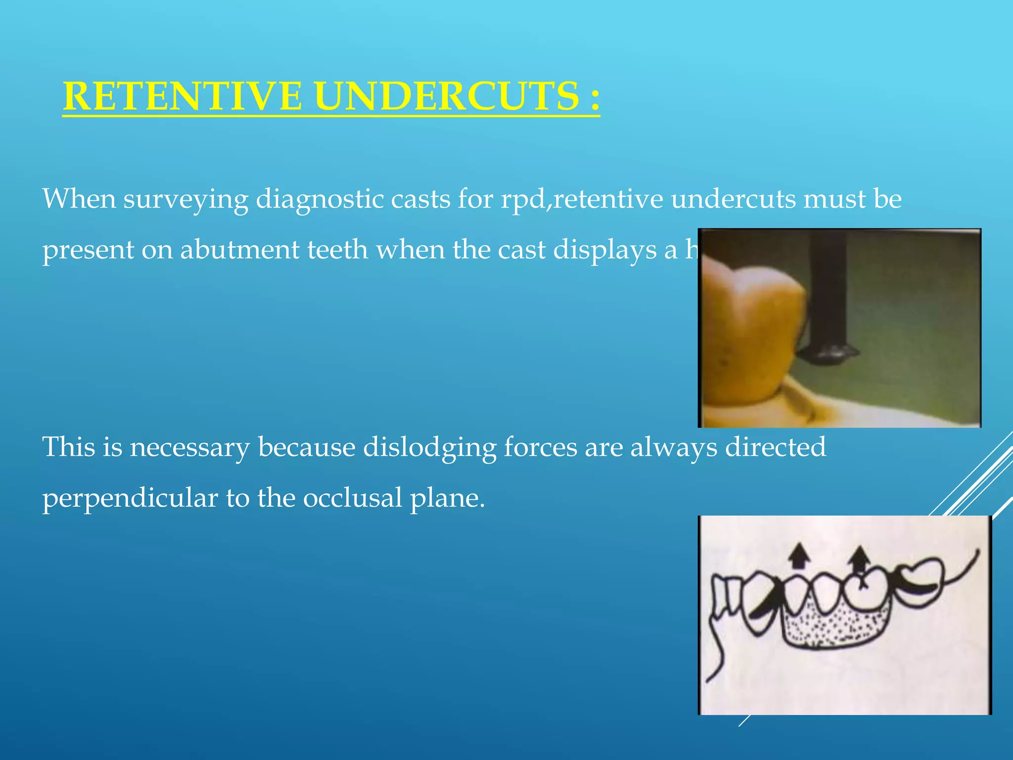Surveyors and surveying in RPD | PPTX