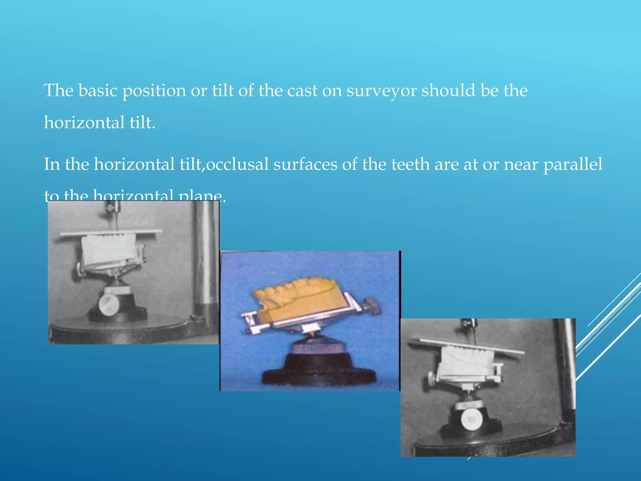 Surveyors and surveying in RPD | PPTX