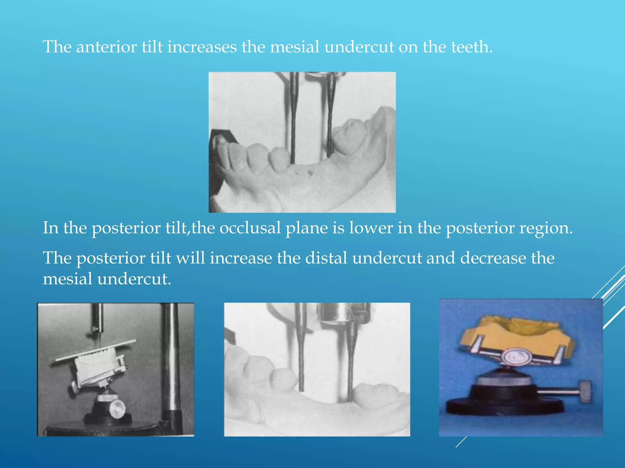 Surveyors and surveying in RPD | PPTX