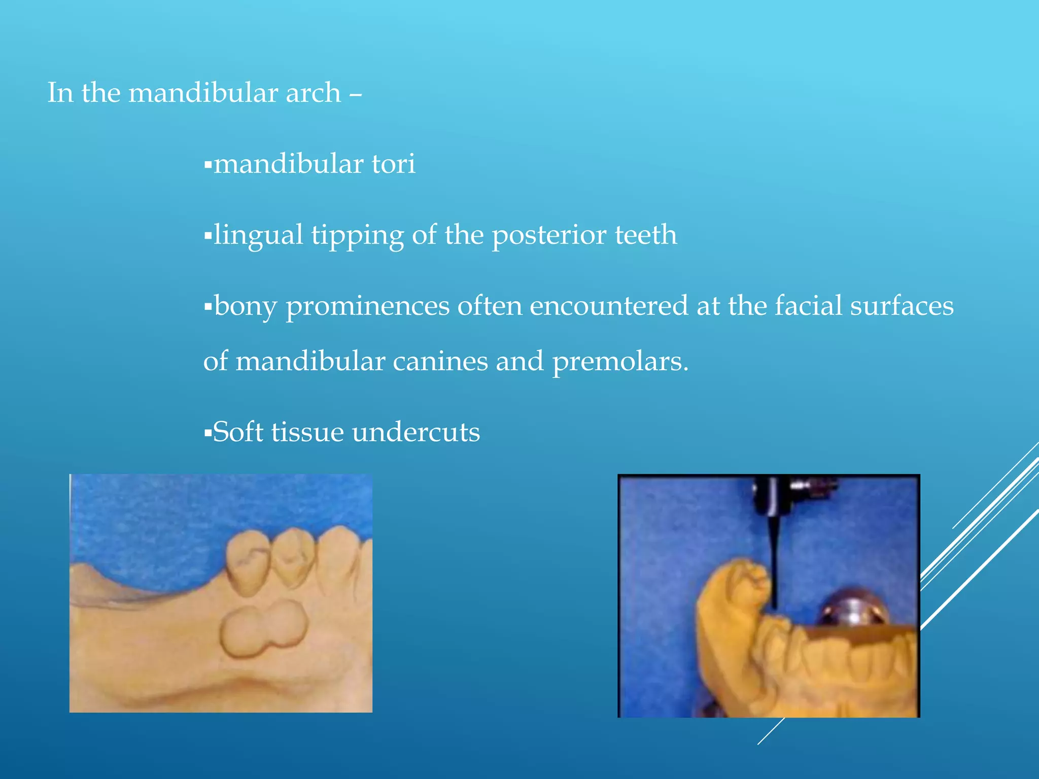 Surveyors and surveying in RPD | PPTX