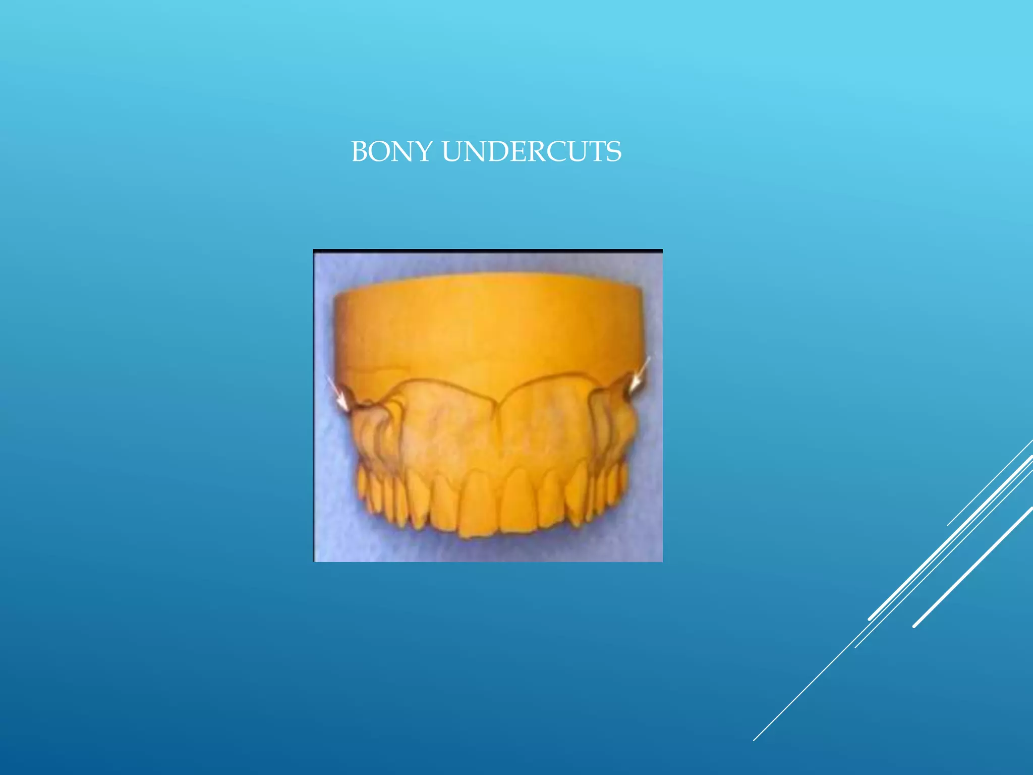 Surveyors and surveying in RPD | PPTX