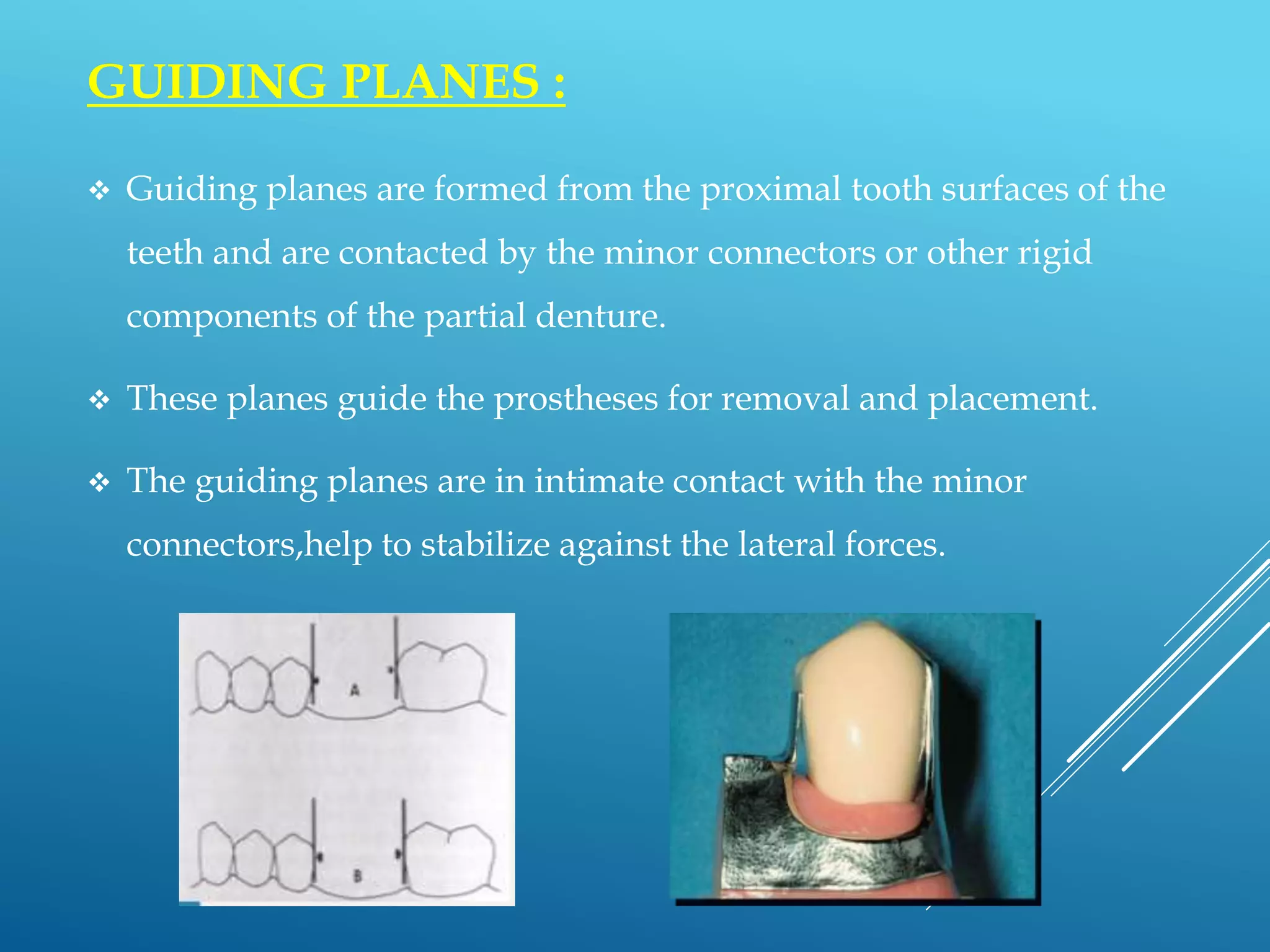Surveyors and surveying in RPD | PPTX