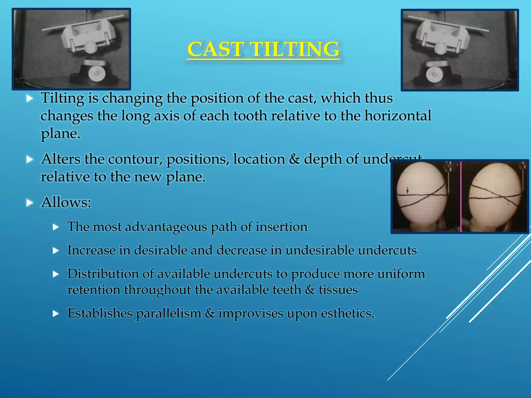 Surveyors and surveying in RPD | PPTX