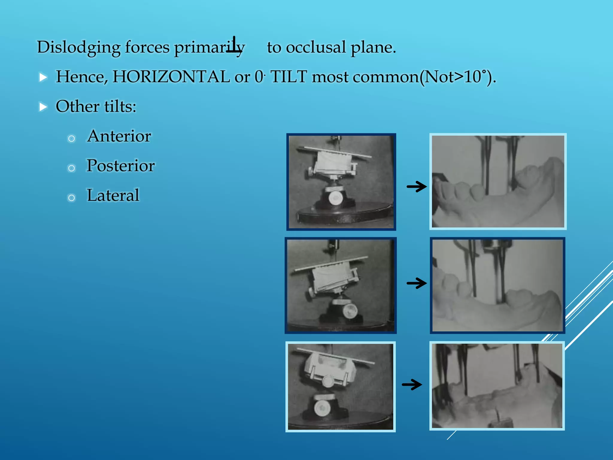 Surveyors and surveying in RPD | PPTX