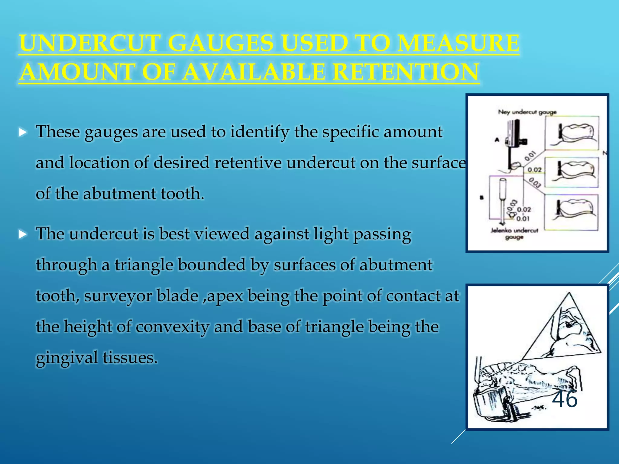 Surveyors and surveying in RPD | PPTX
