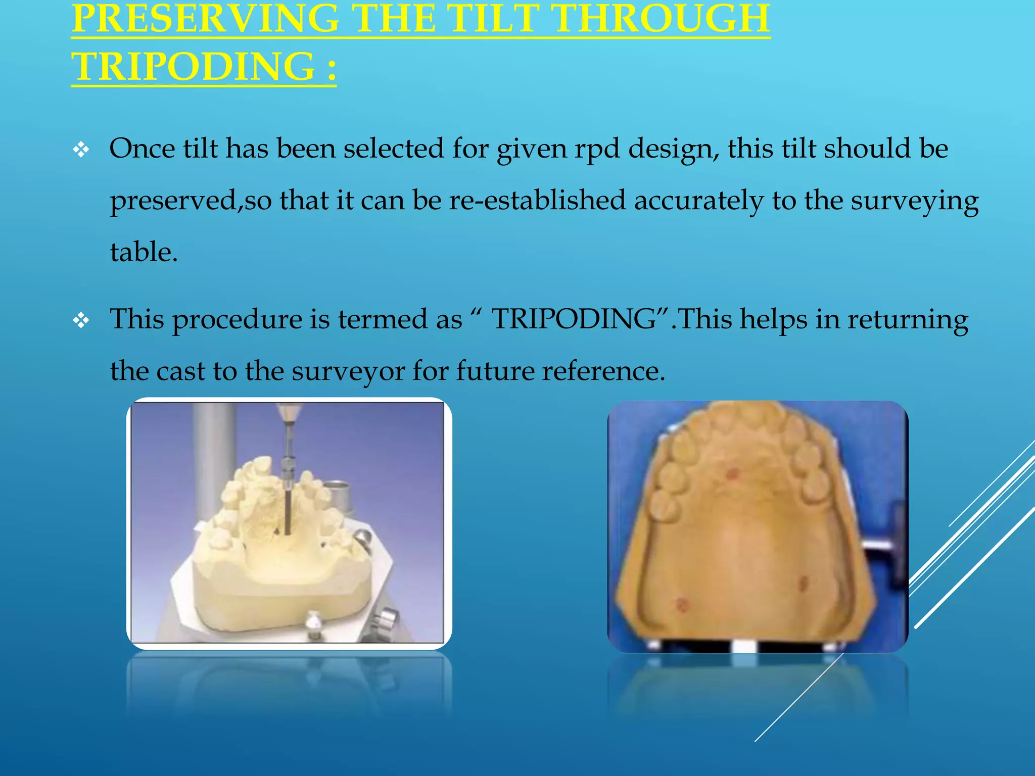 Surveyors and surveying in RPD | PPTX