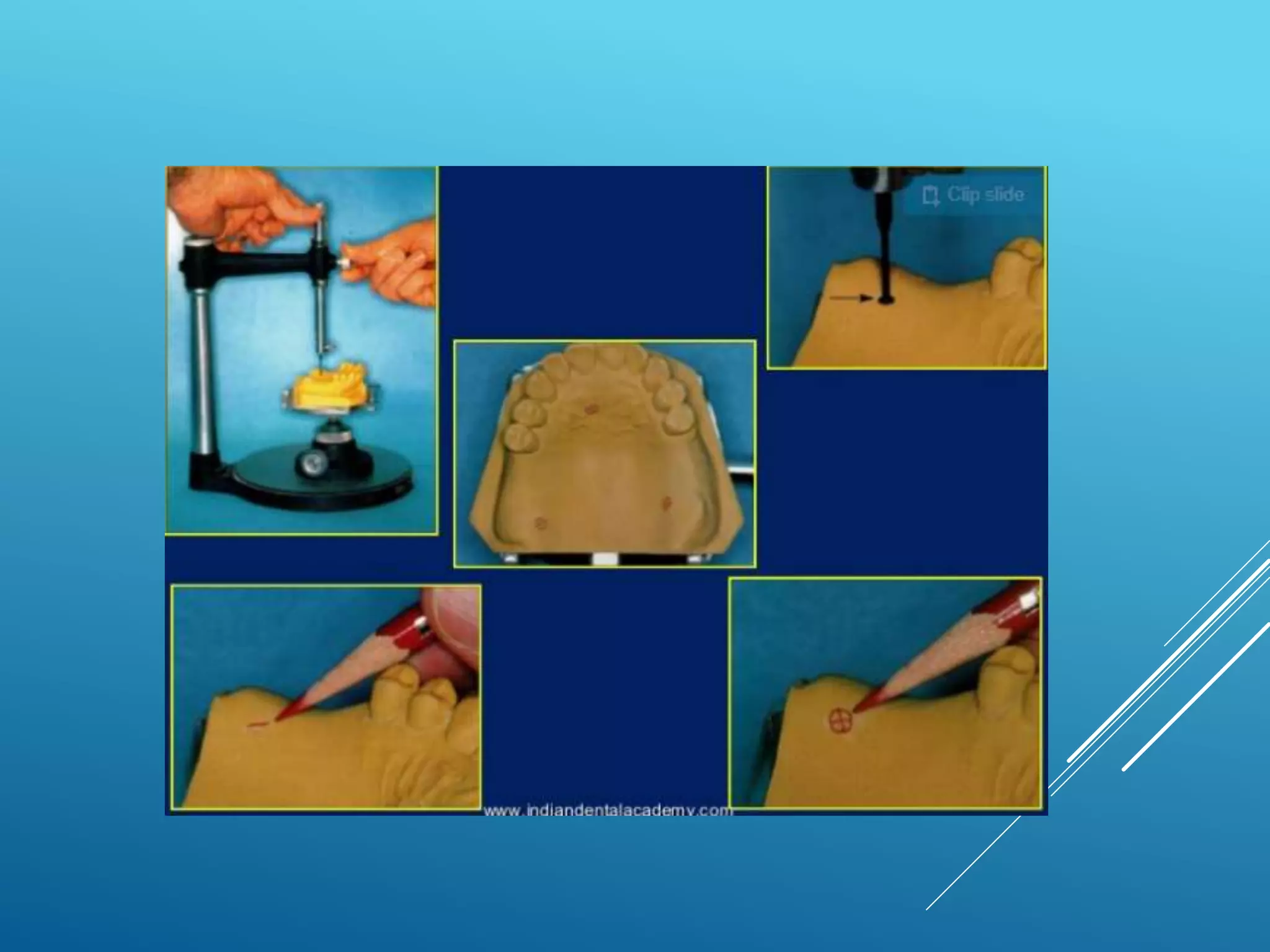 Surveyors and surveying in RPD | PPTX