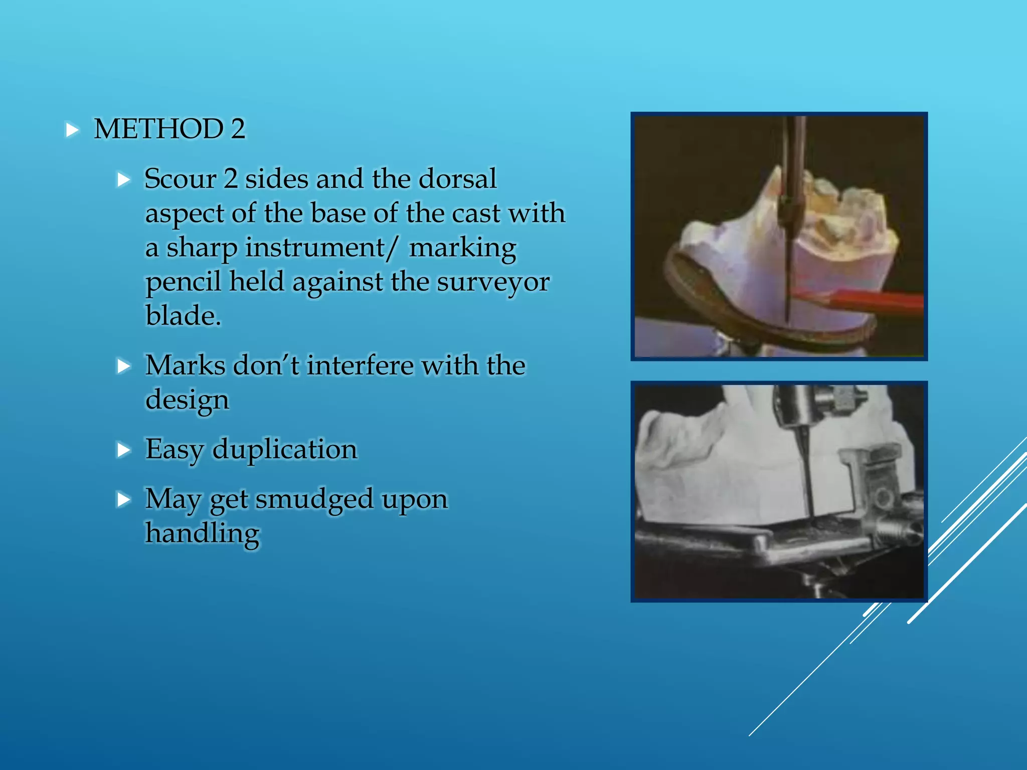 Surveyors and surveying in RPD | PPTX