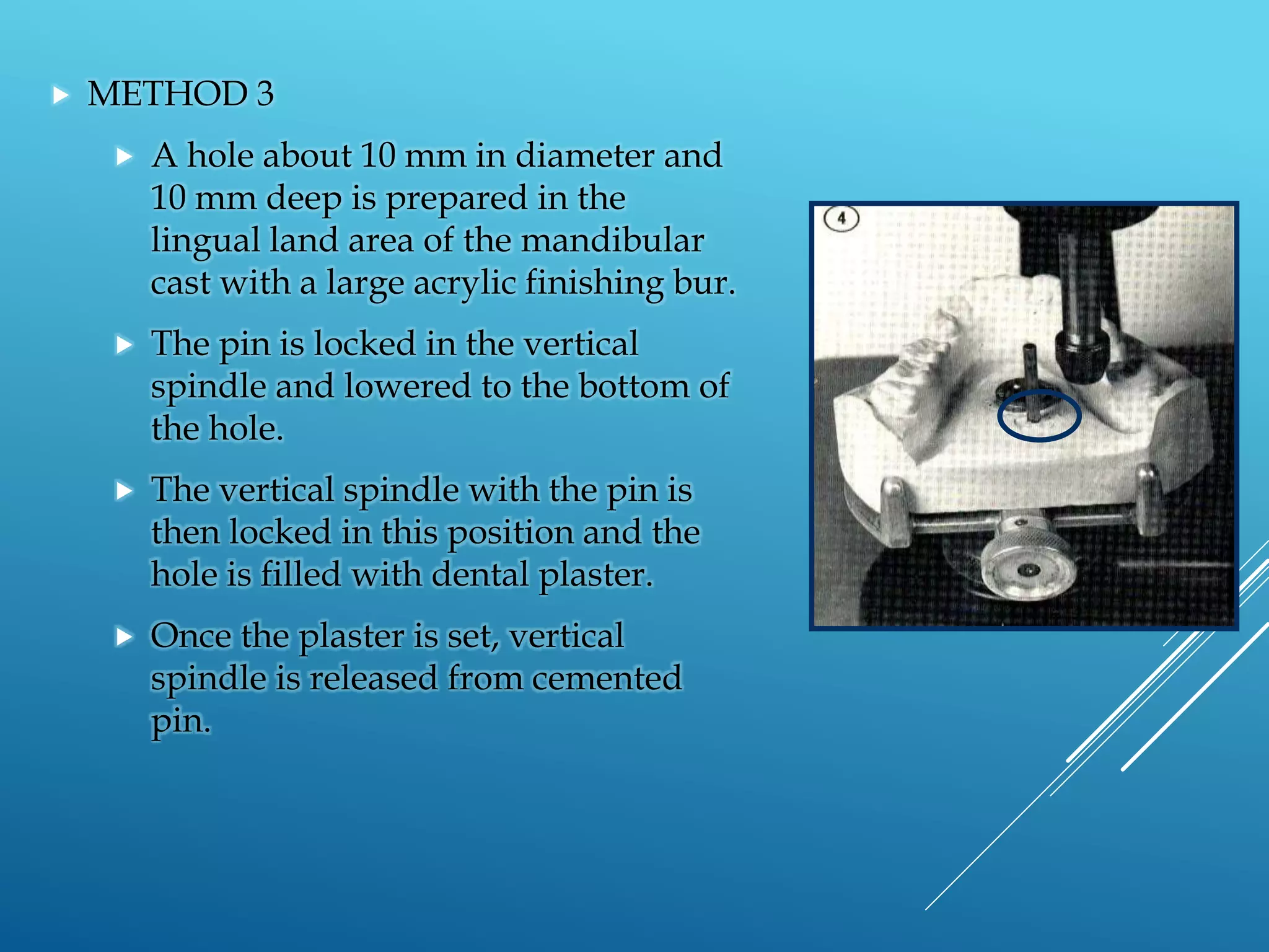 Surveyors and surveying in RPD | PPTX