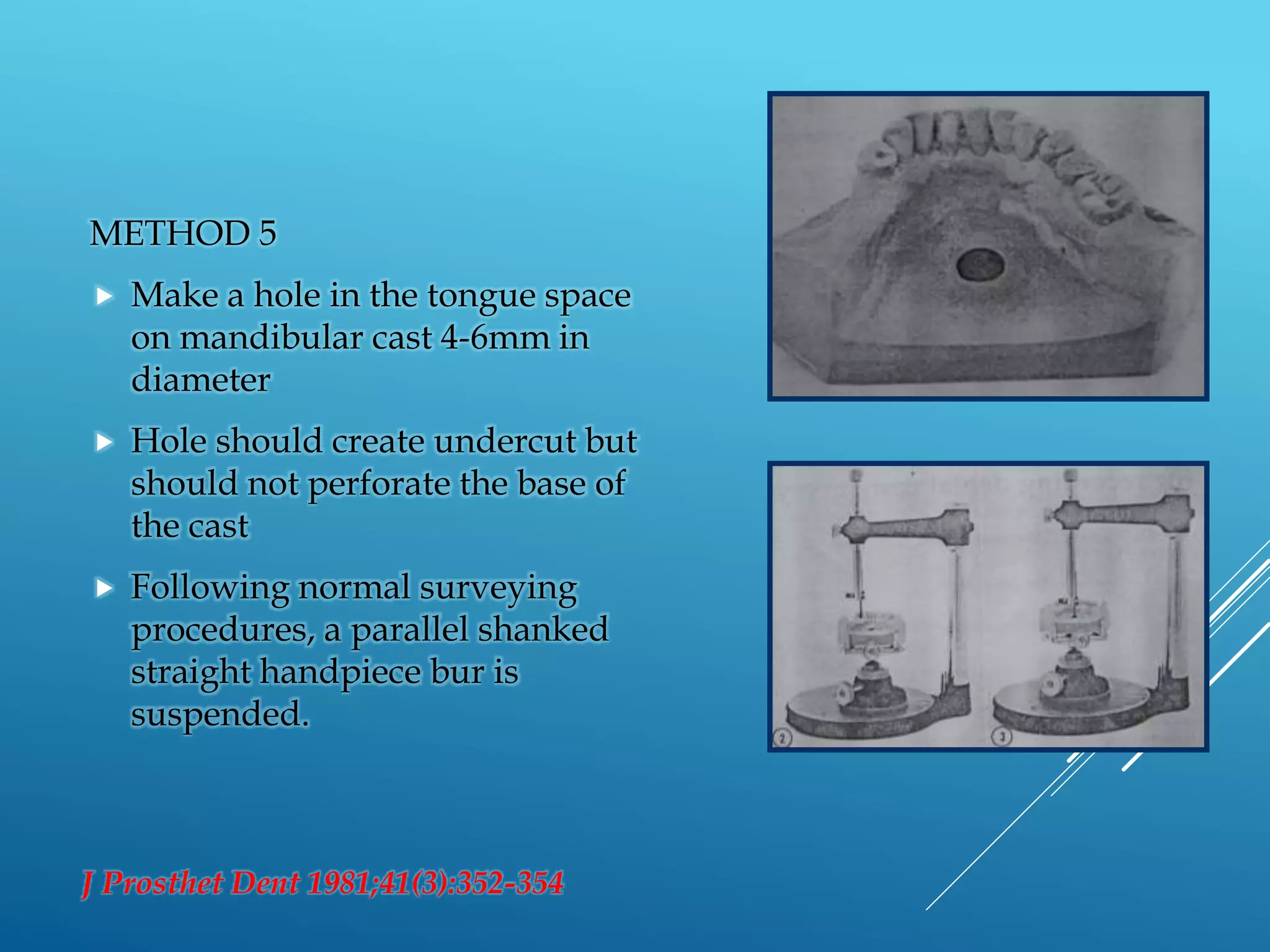 Surveyors and surveying in RPD | PPTX