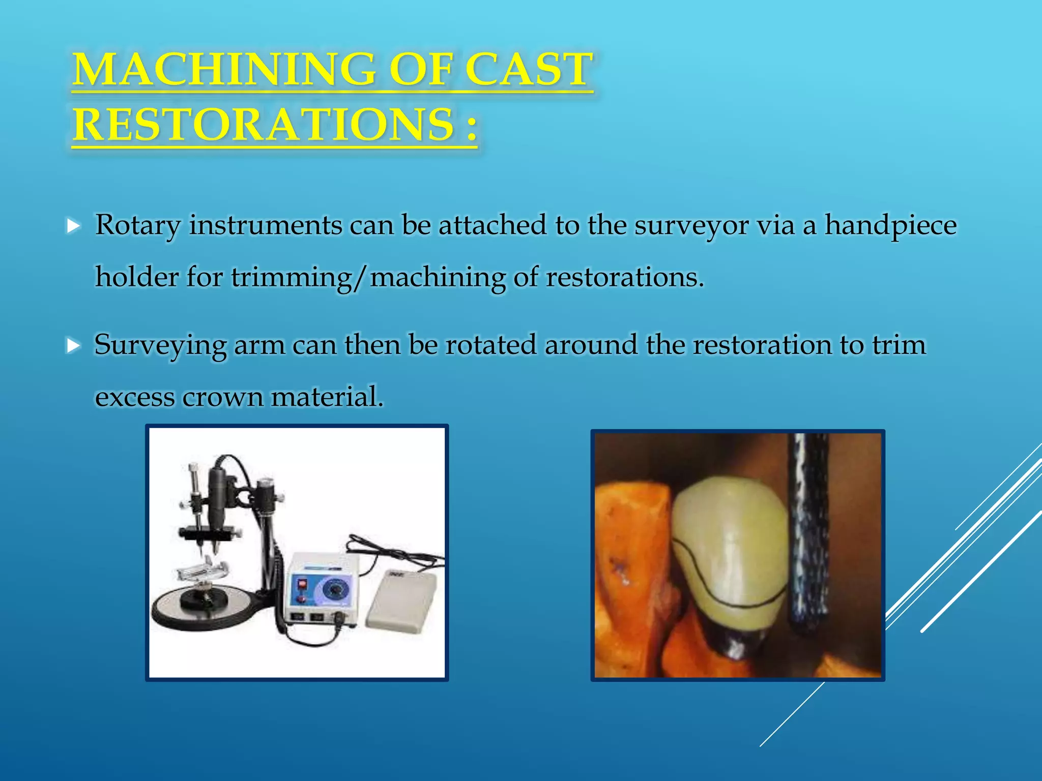Surveyors and surveying in RPD | PPTX