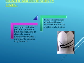 Surveyors and surveying in RPD | PPTX