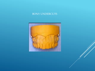 Surveyors and surveying in RPD | PPTX