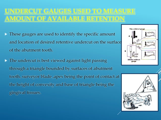 Surveyors and surveying in RPD | PPTX | Dental Health | Diseases and ...