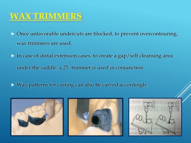 Surveyors and surveying in RPD | PPTX | Dental Health | Diseases and ...