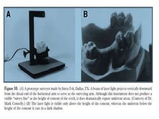 Surveyors and surveying in RPD | PPTX