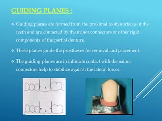 Surveyors and surveying in RPD | PPT