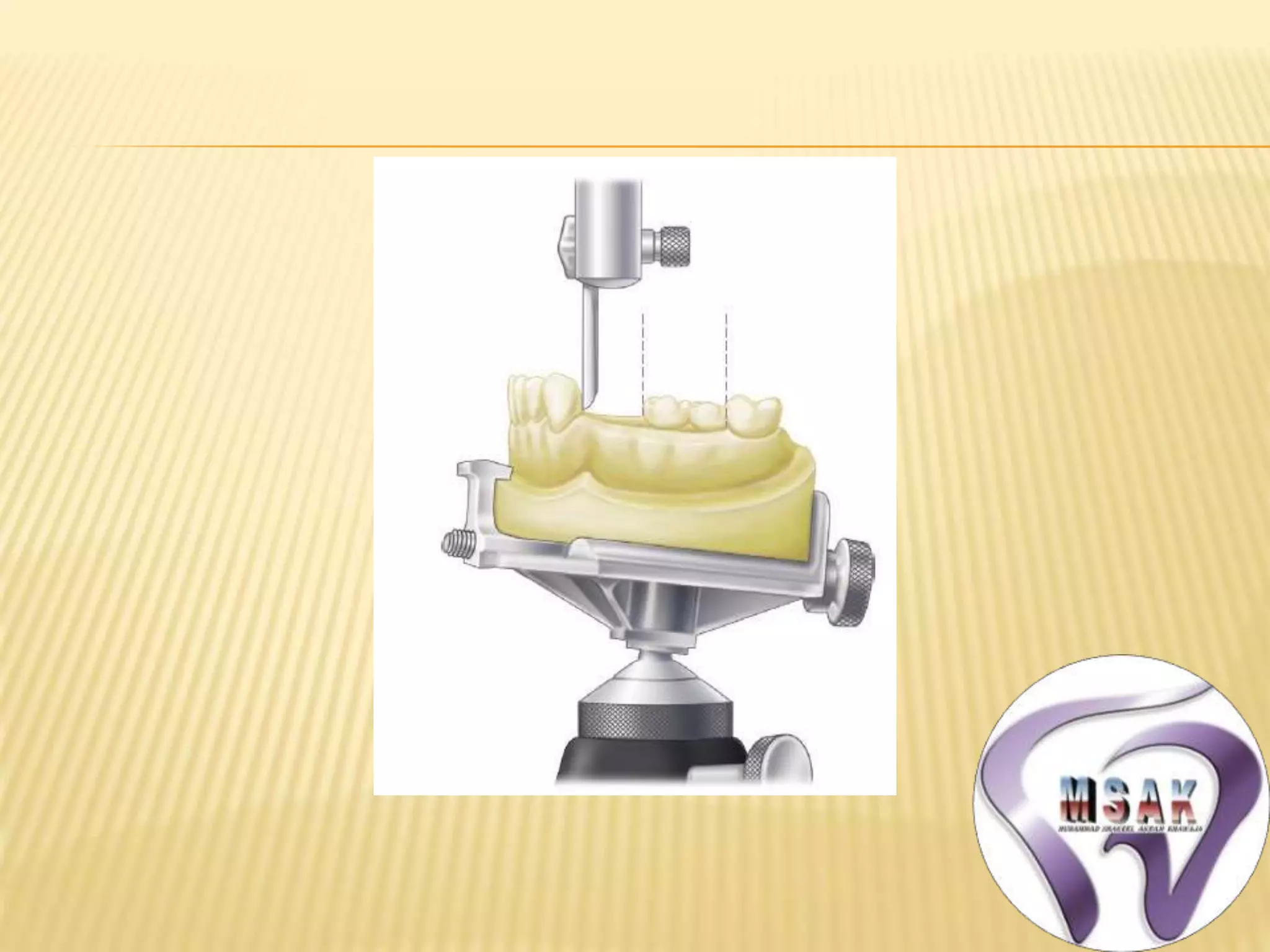 Surveying of cast for rpd | PPTX