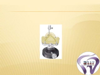 Surveying of cast for rpd | PPTX