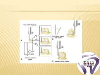 Surveying of cast for rpd | PPTX