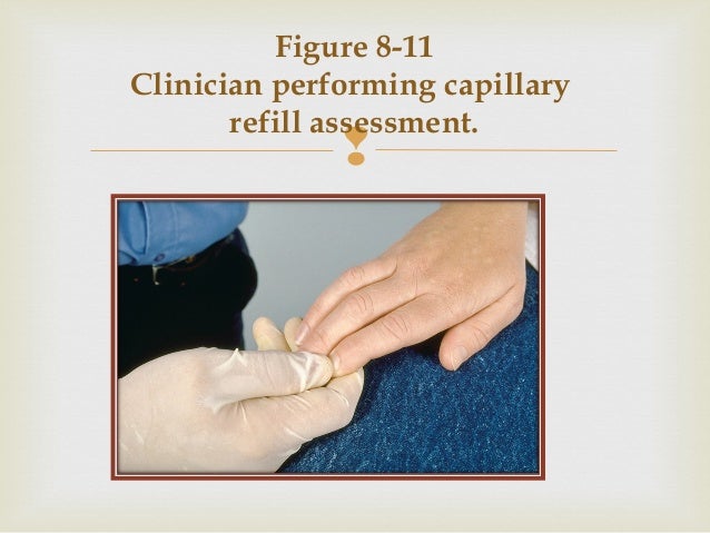 Survey of Anatomy and Physiology Chap 8