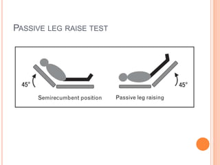 Surviving Sepsis Campaign 2021 guidelines.pptx