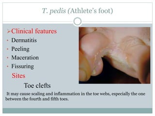 Surya kant agarwal | PPT