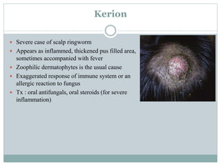 Surya kant agarwal | PPT